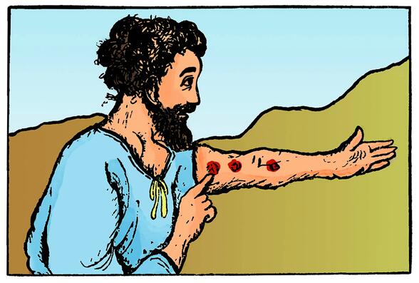 Mandamientos sobre la Lepra en la Biblia